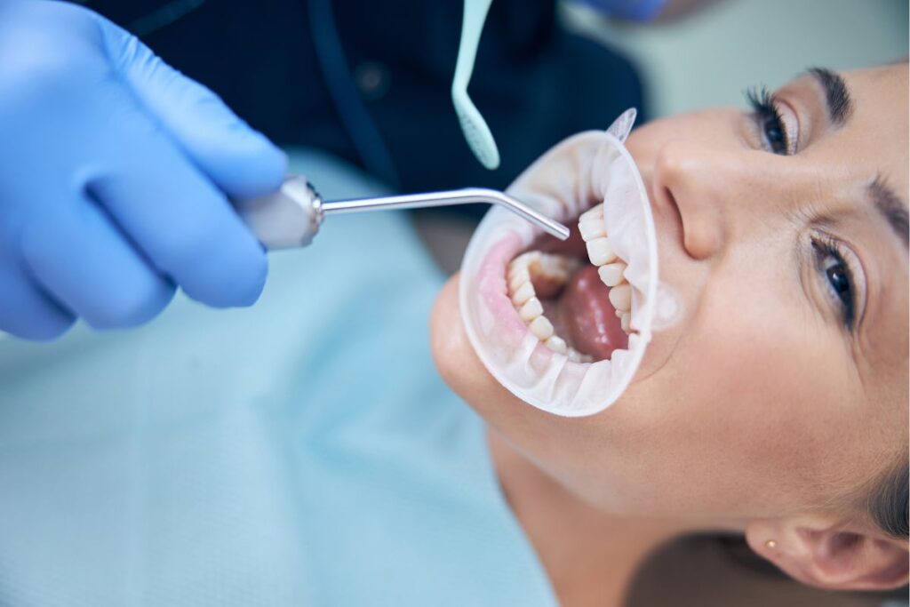 Understanding Dental Bone Graft: Procedure, Recovery, and Cost ...